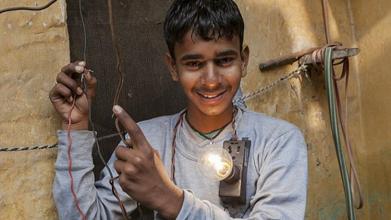 Meet The Real Electric Boy Who Can Withstand 11,000 Volts