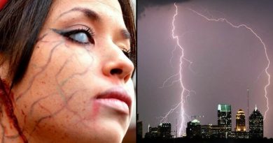 These 10 People Miraculously Survived After Struck By Lightning